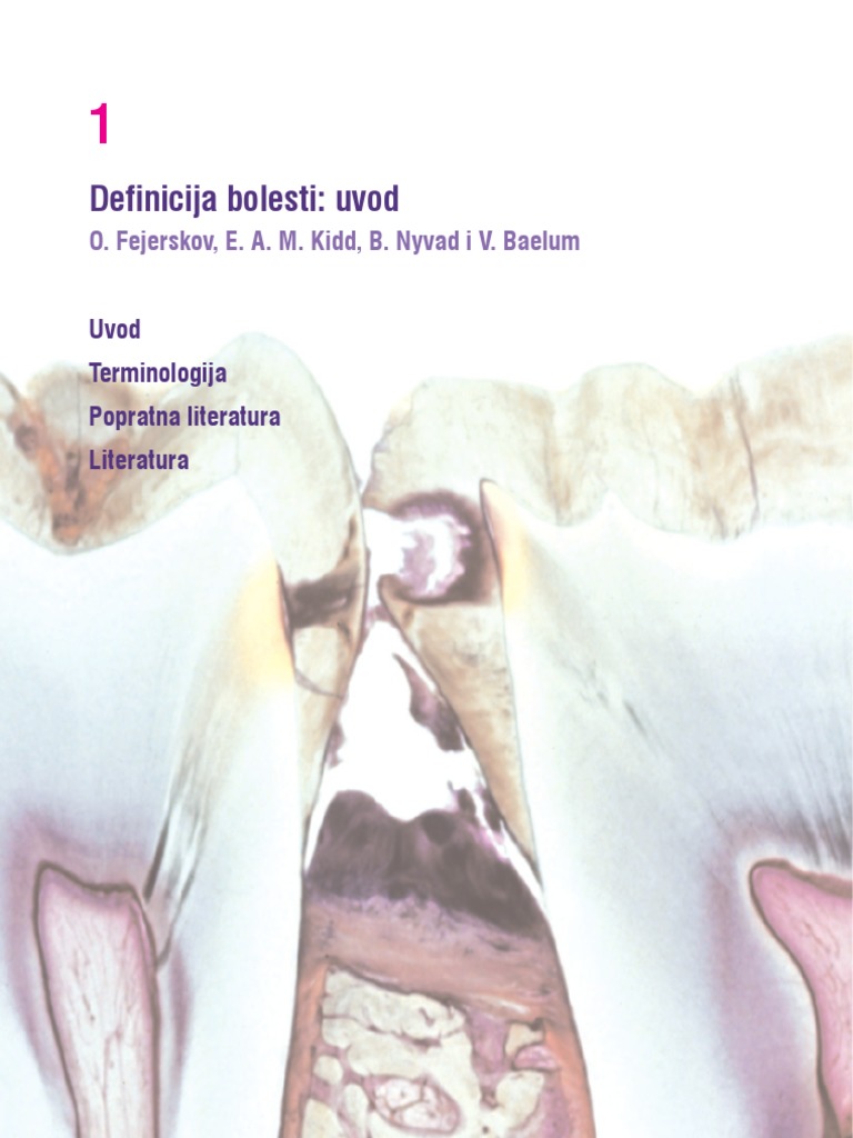 Karijes korjena | PDF