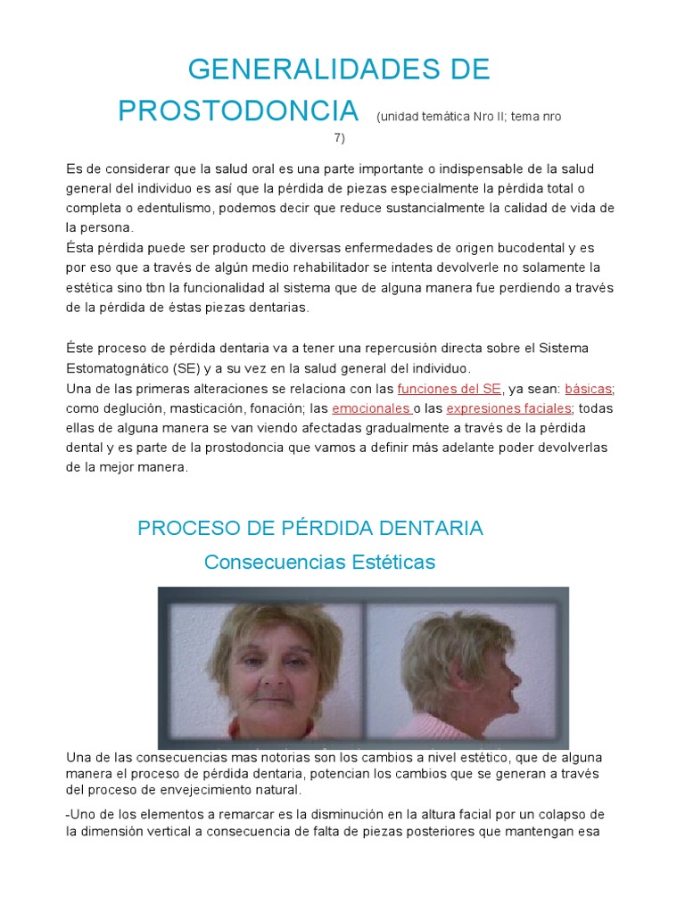 Generalidades de Prostodoncia | PDF | Dentadura postiza
