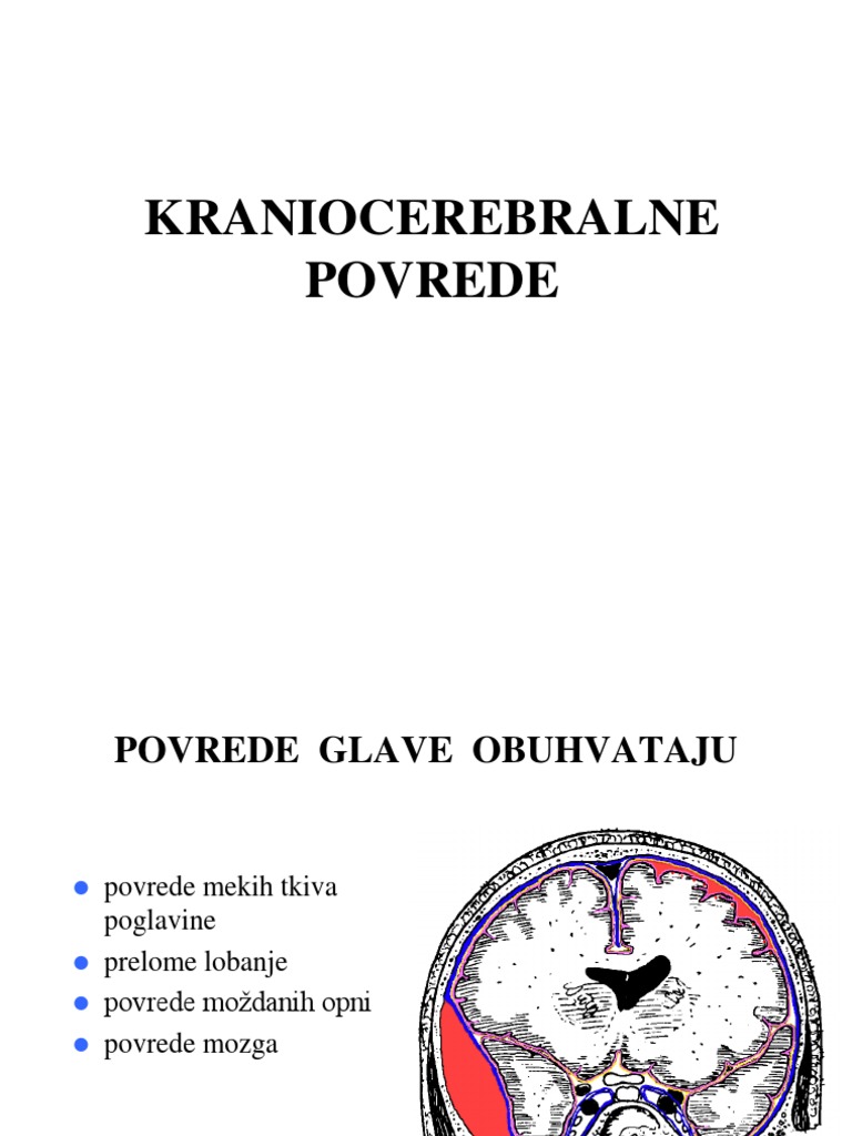 4 Kraniocerebralne Povrede | PDF