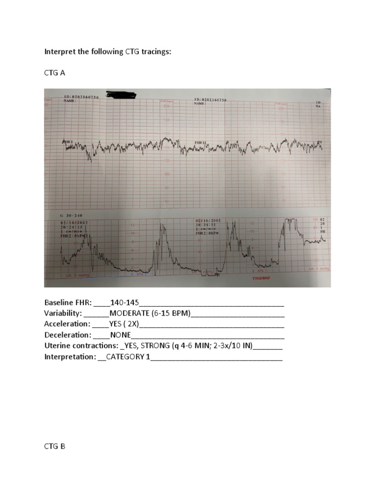 CTG Tracings WITH ANSWER | PDF