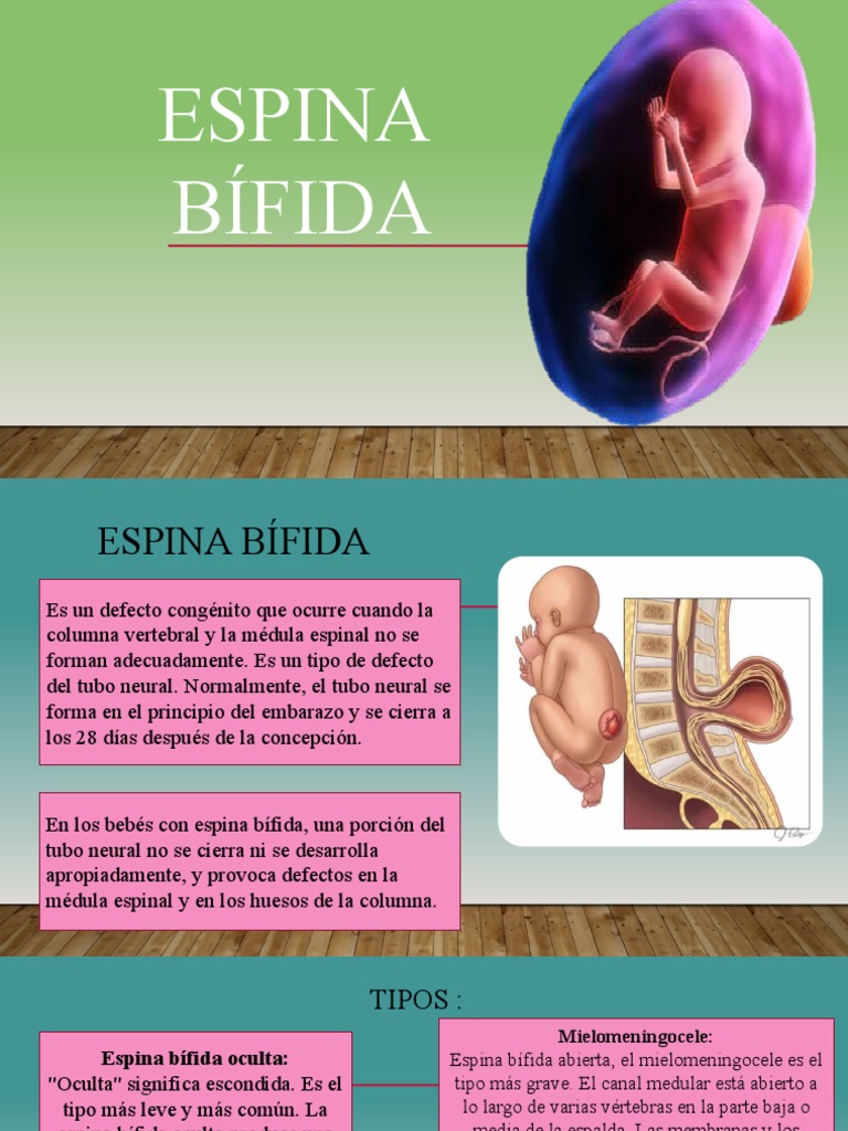 Espina Bifida2 | PDF | Medicina CLINICA | Enfermedades y trastornos humanos