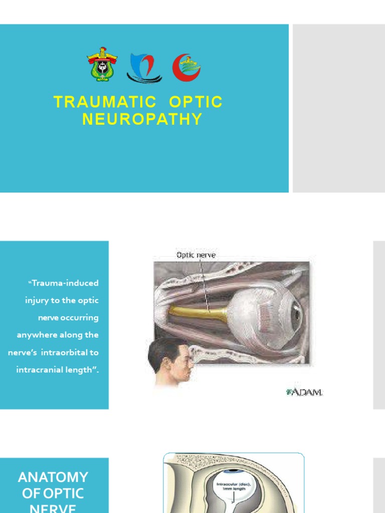 Traumatic Optic Neuropathy Overview | PDF | Injury | Vision