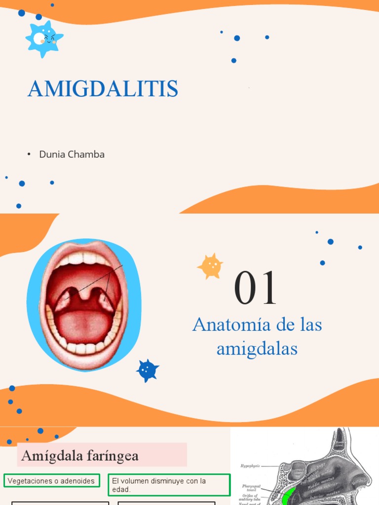 AMIGDALITIS | PDF | Epidemiología | Medicina