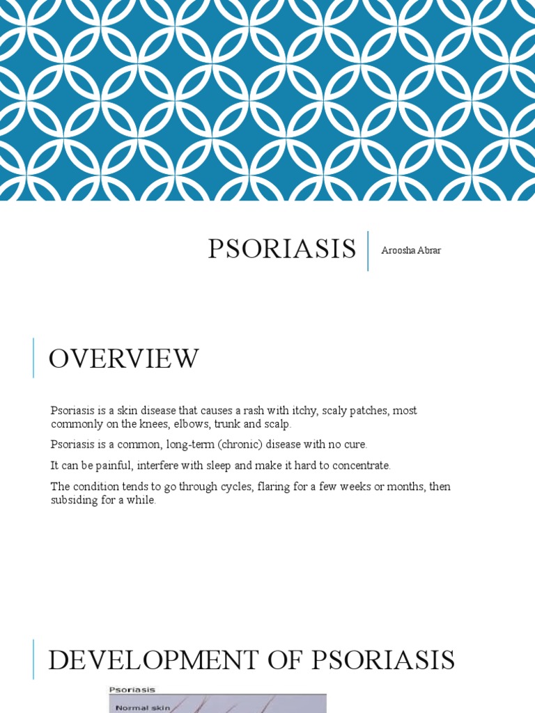 Understanding Psoriasis: Symptoms & Treatment | PDF | Psoriasis ...