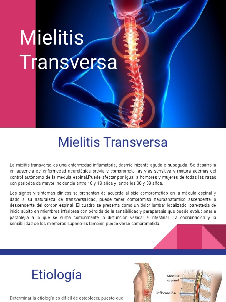 Mielitis Transversa | PDF | Médula espinal | Inmunología