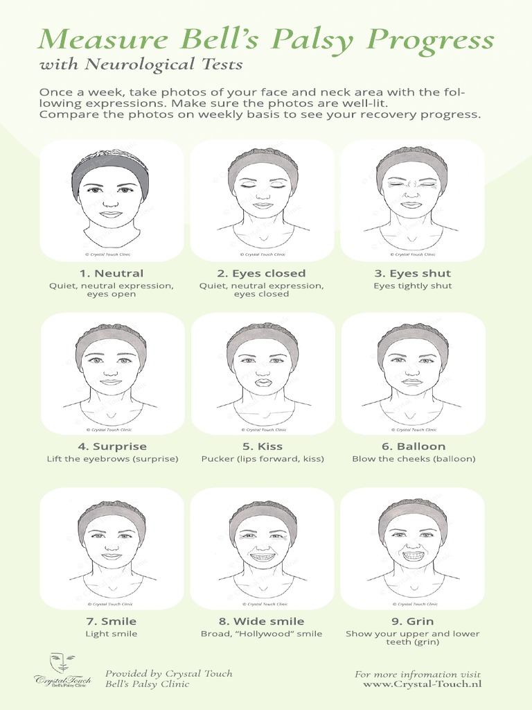 Measure Bells Palsy Progress With Neurological Tests by Crystal Touch ...