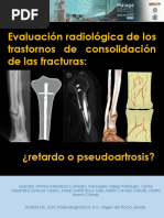 Clasificacion de Frykman | PDF