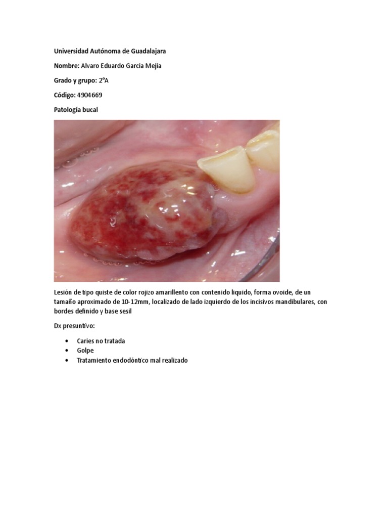 Descripcion de Lesiones GARCIA MEJIA 2°A | PDF