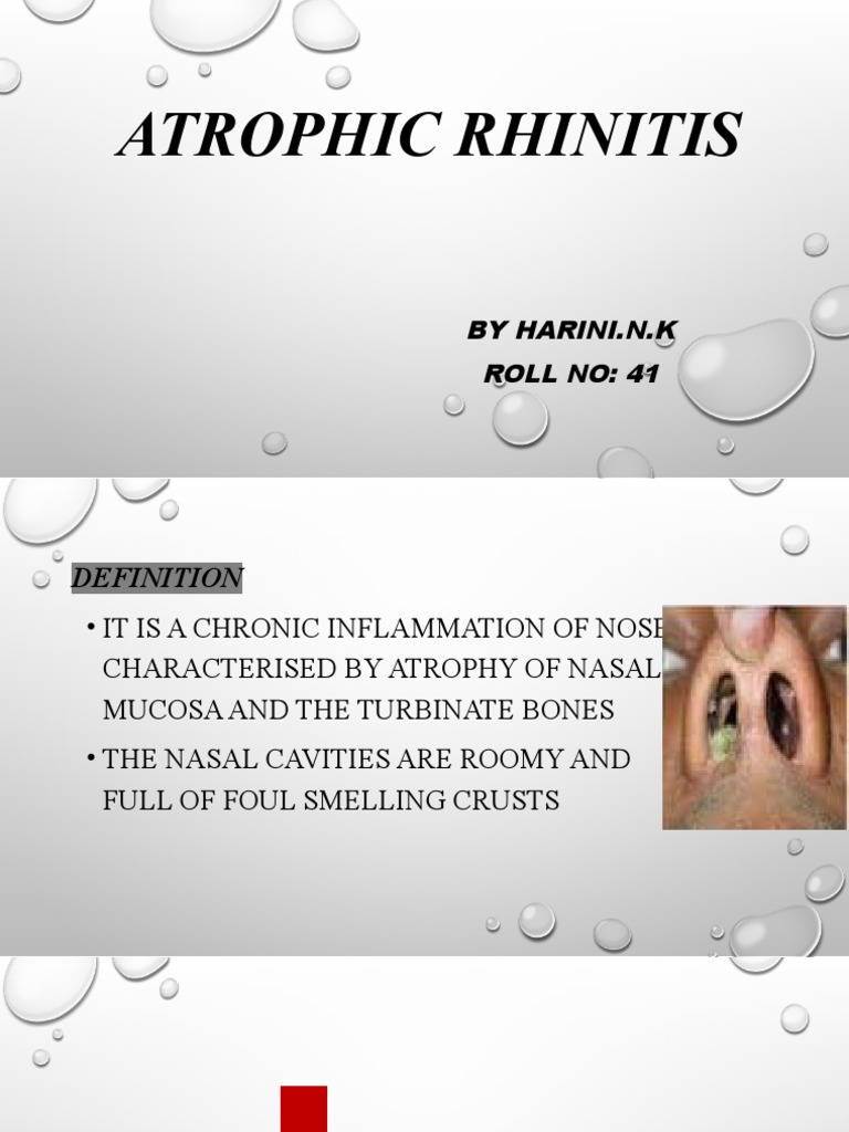 Atrophic Rhinitis | PDF | Human Nose | Atrophy