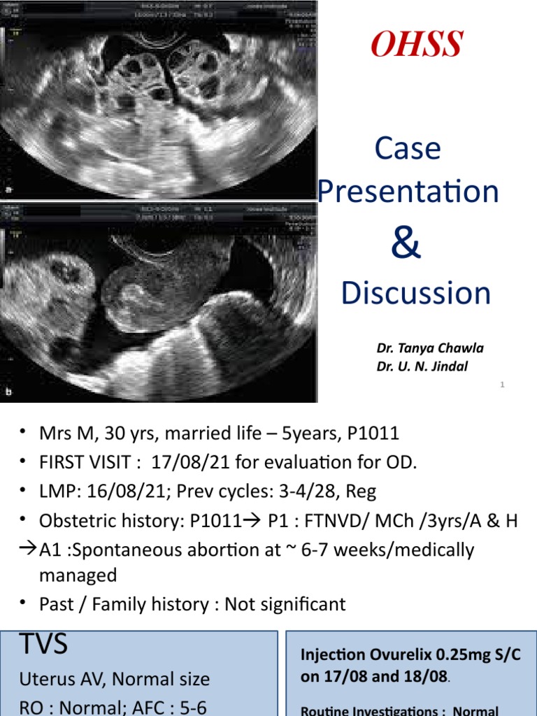 OHSS Case Presentation Discussion - Jindal IVF CHD | PDF | Medicine ...