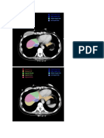 CT Chest Anatomy Usc/Som Department of Radiology Kirk Peterson, MD ...