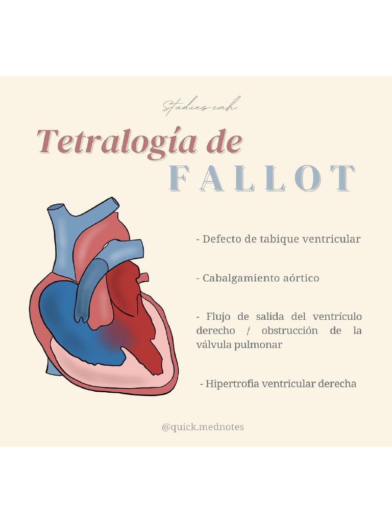 Tetralogia de Fallot | PDF