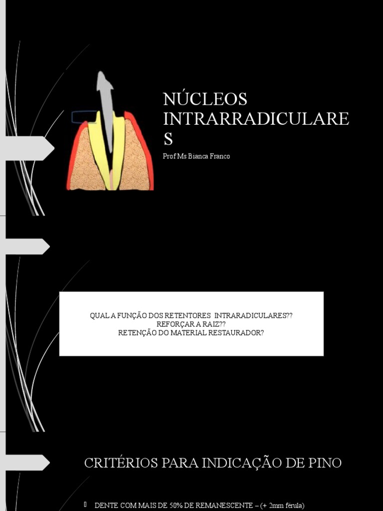 Retentor Intra Radicular | PDF | Dente | Materiais