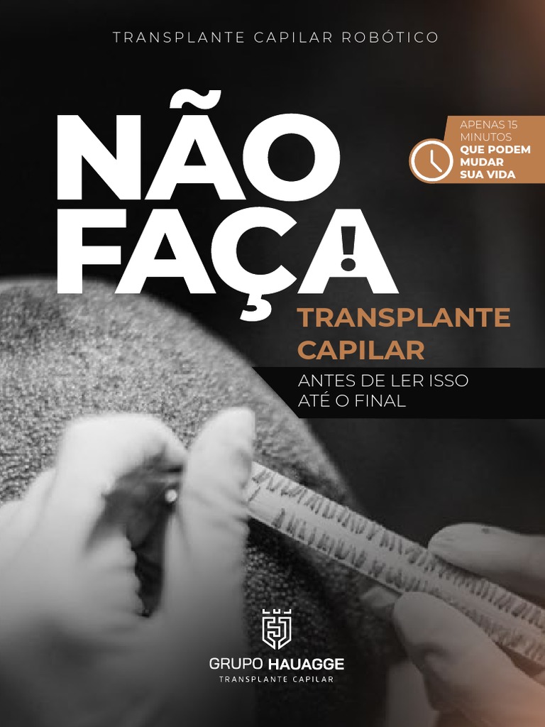 E Book Transplante Capilar 1 | PDF | Transplante de órgãos | Cabelo