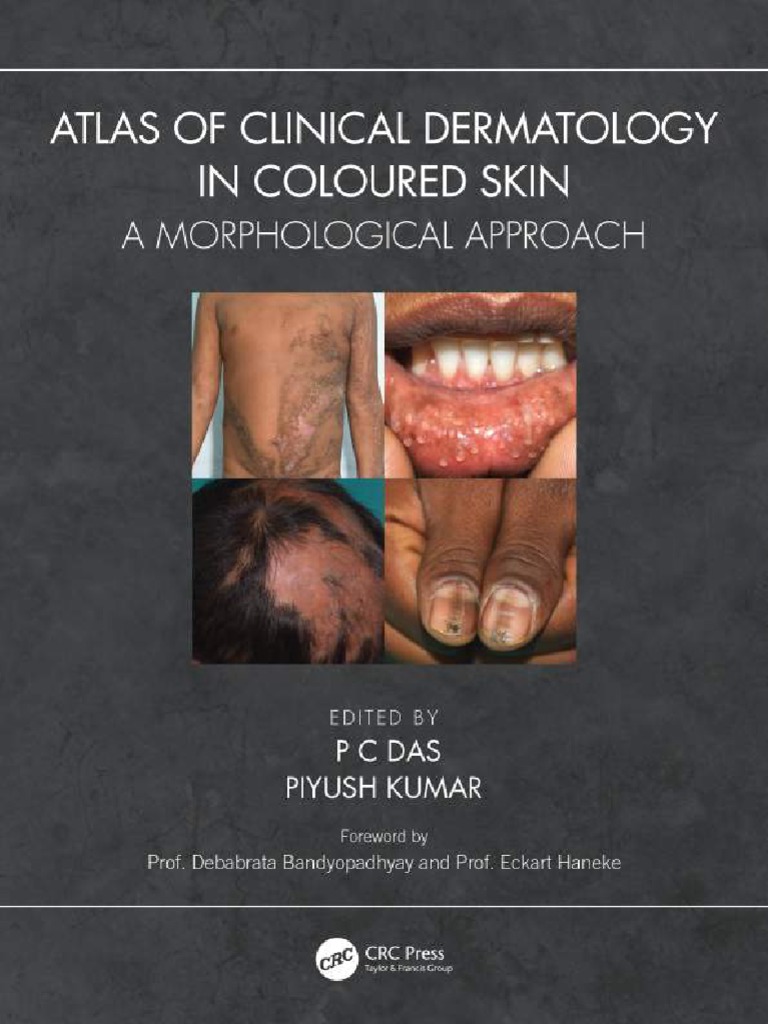 Atlas of Clinical Dermatology in Coloured Skin 2023 Pgs 678 | PDF | Dermatology | Medical Diagnosis