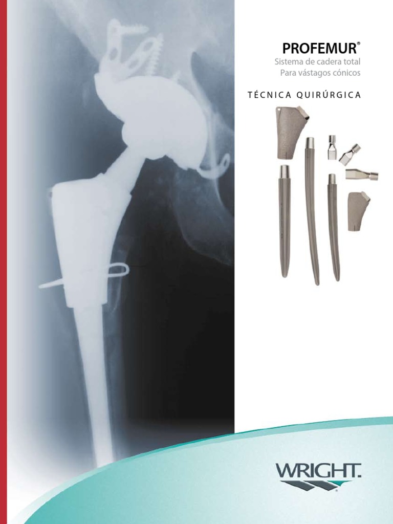 Vastago Profemur (Palex) | PDF | Tornillo