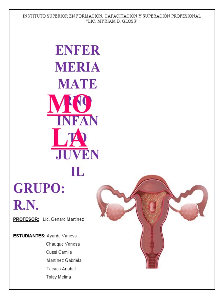 Mola Hidatiforme Final Gabi | PDF | El embarazo | Gonadotropina ...