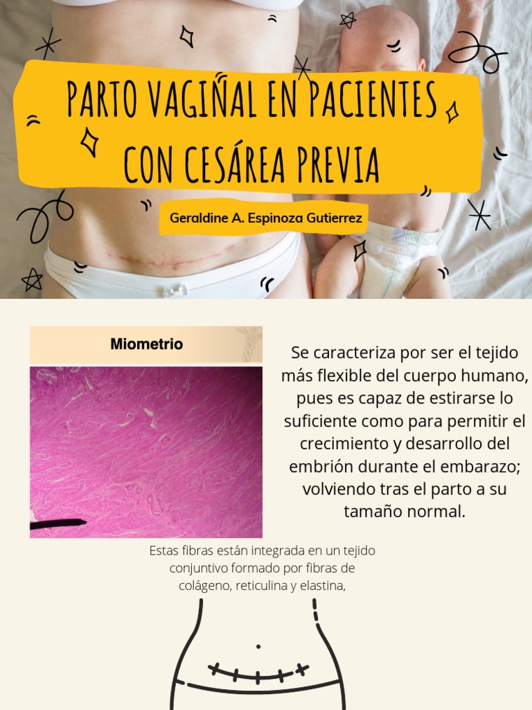 Parto Vaginal Tras Cesárea Previa | PDF | Parto | Seccion de cesárea