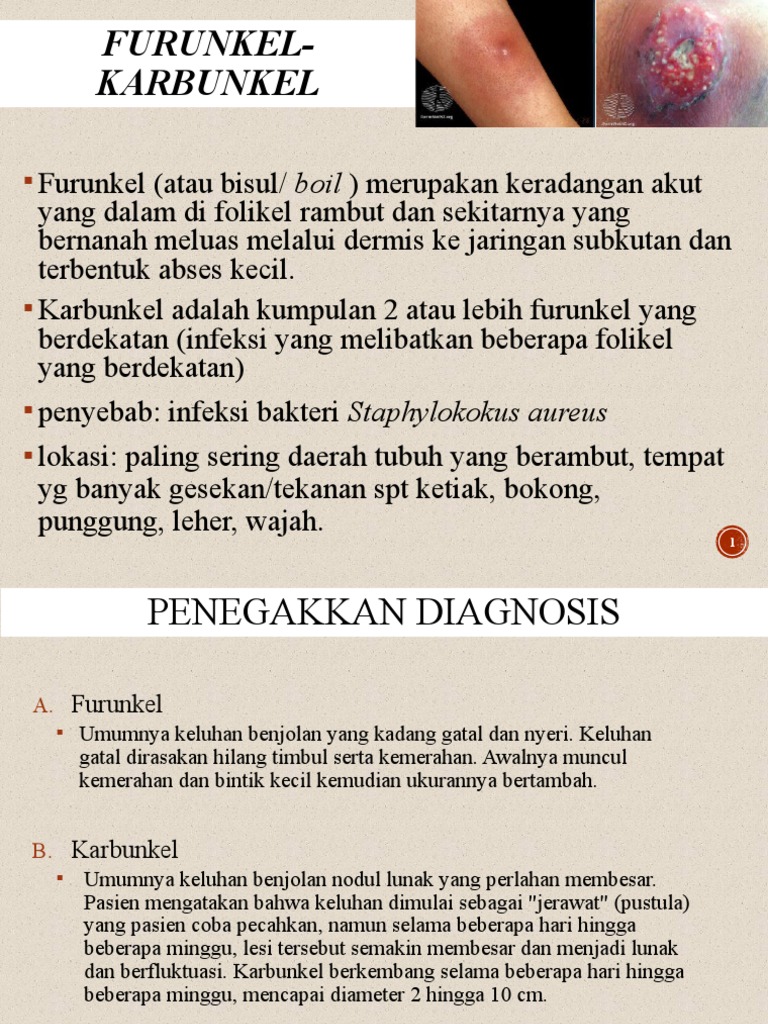 Furunkel Karbunkel Fix | PDF