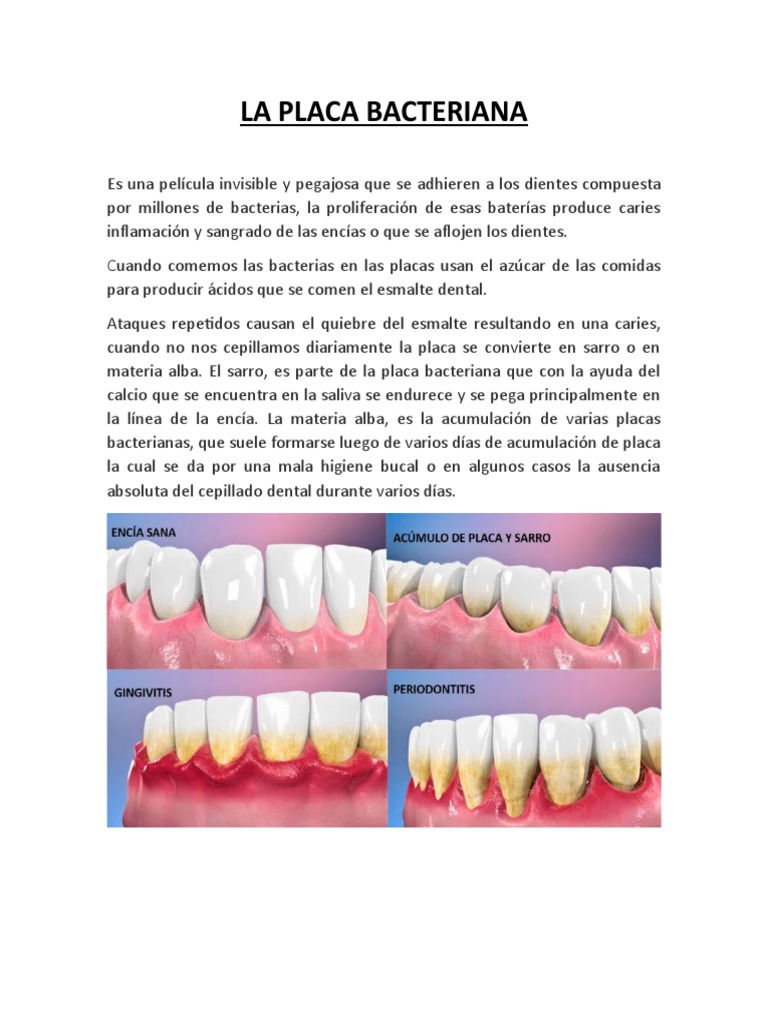La Placa Bacteriana | PDF