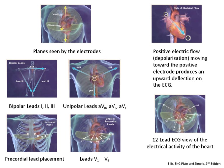 12 Lead ECG 3D View | PDF