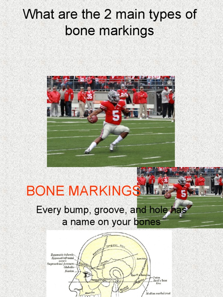 Bone Markings-0 | PDF