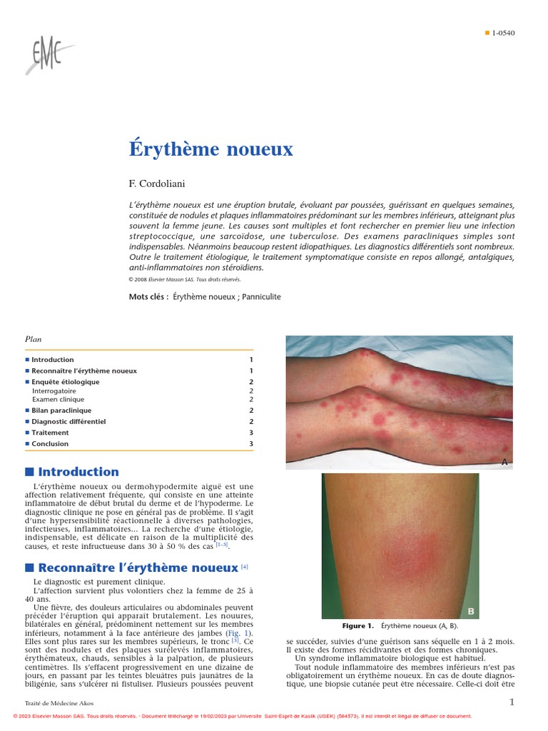 Érythème noueux : causes et traitements | PDF | Tuberculose | Streptocoque