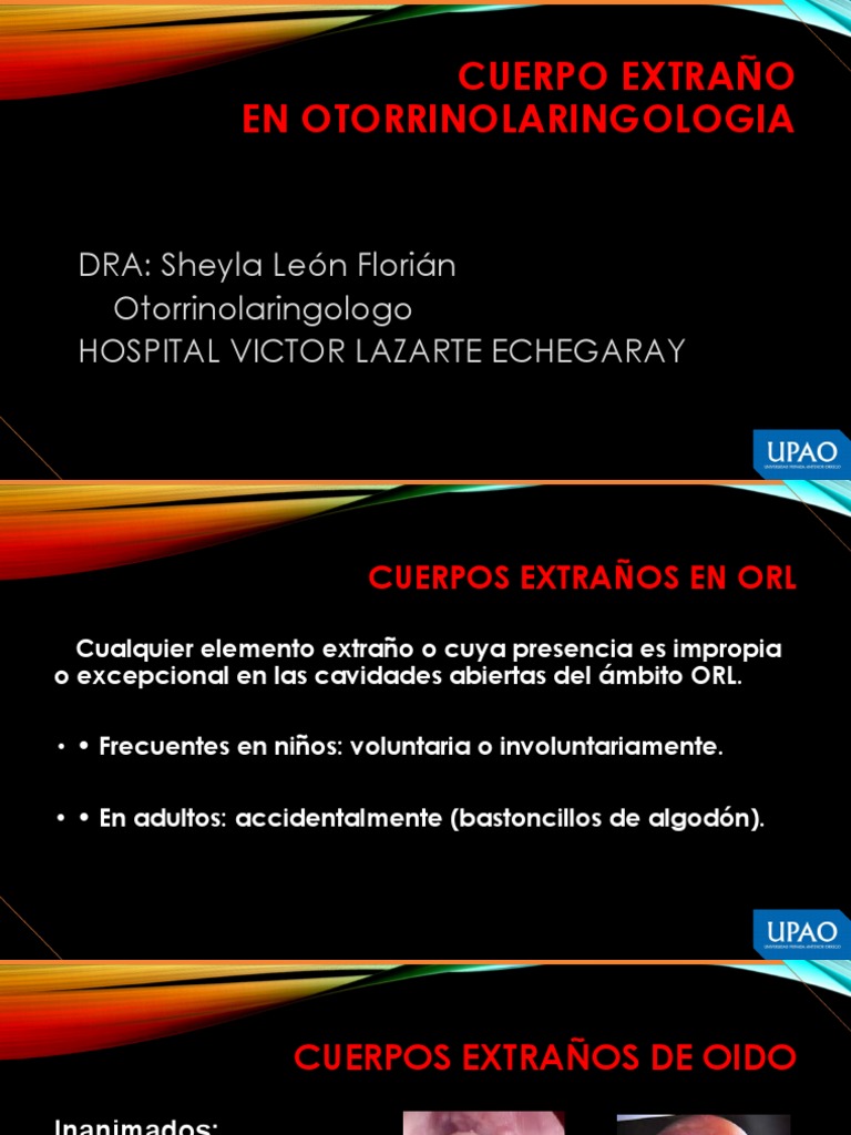 Cuerpos Extraños Orl | PDF