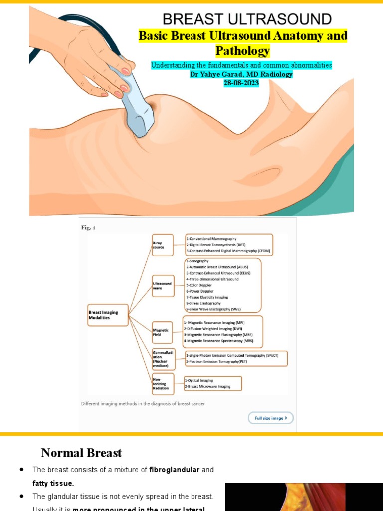 Basic Breast Ultrasound Anatomy and Pathology | PDF