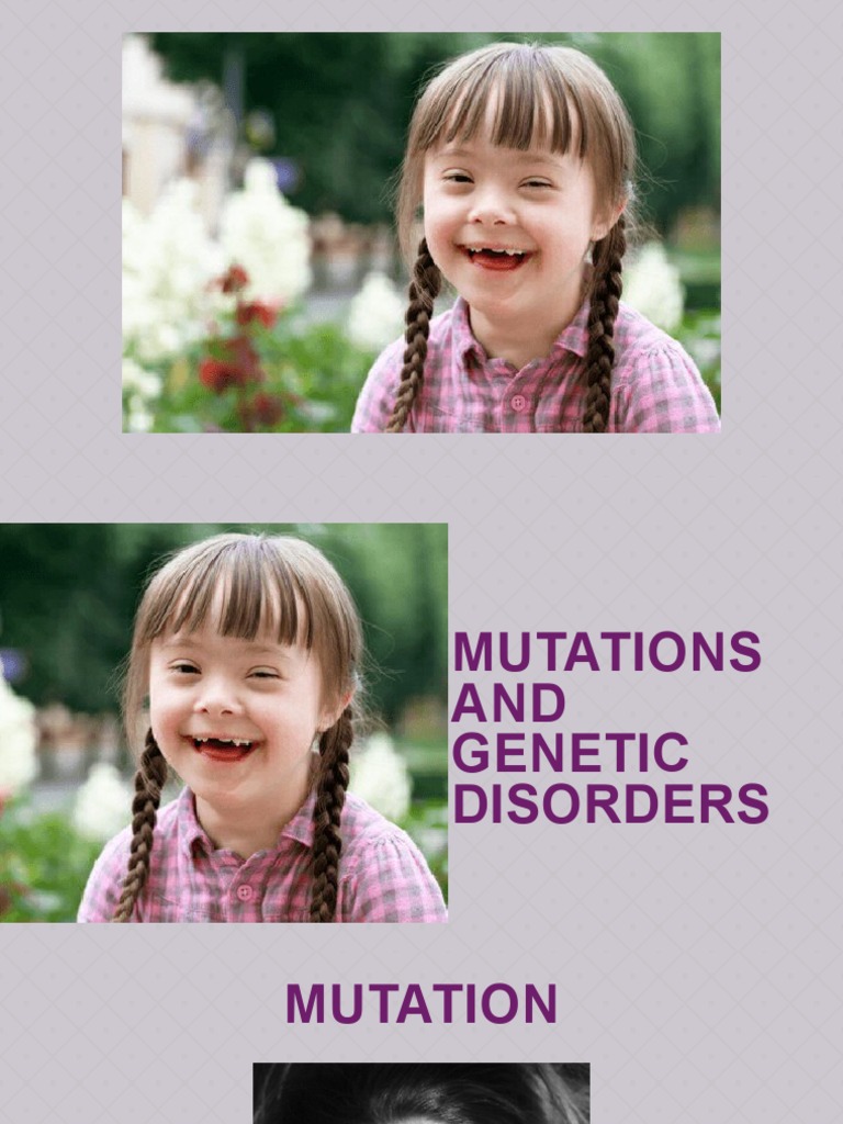Down Syndrome and Genetic Mutations | PDF | Genetic Disorder | Down ...
