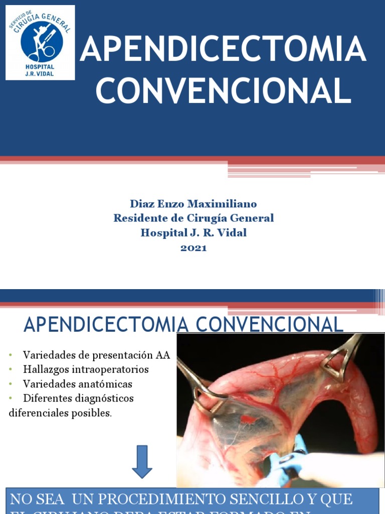 Apendicectomia Convencional | PDF