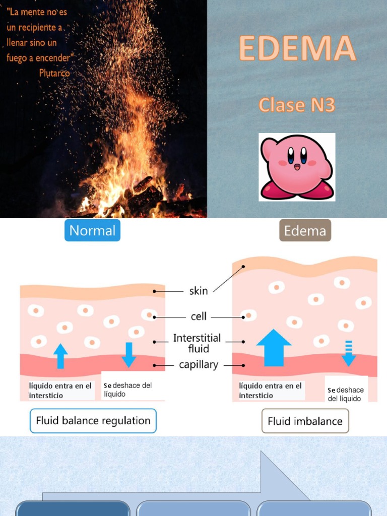EDEMA Clase3 | PDF