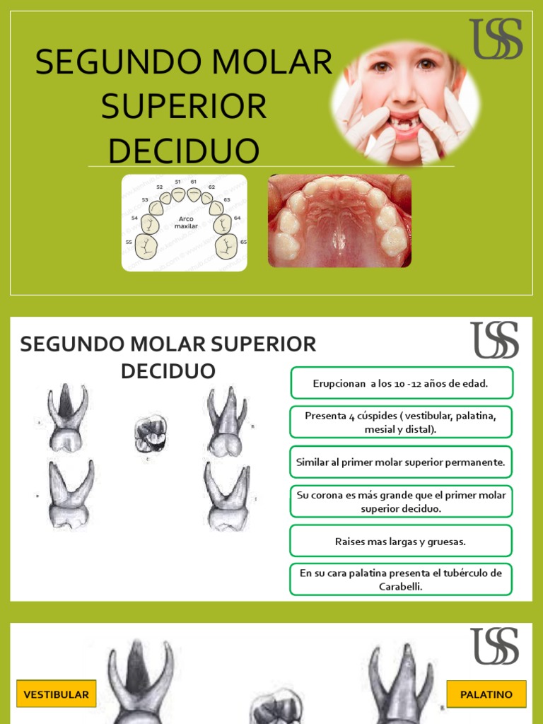 SEGUNDO MOLAR SUPERIOR DECIDUOOOOO | PDF