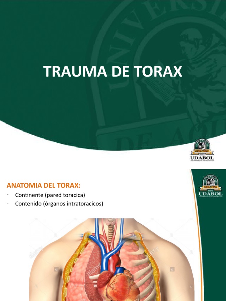 Trauma Toracico | PDF