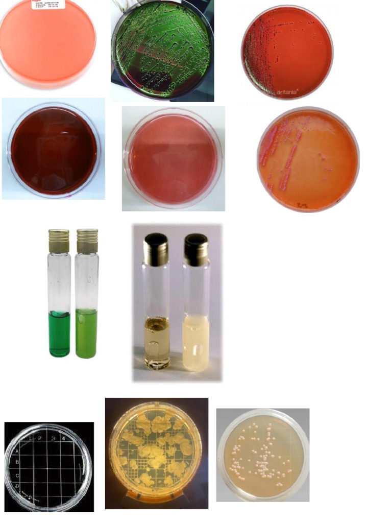 AGARES MICROBIOLOGIA | PDF