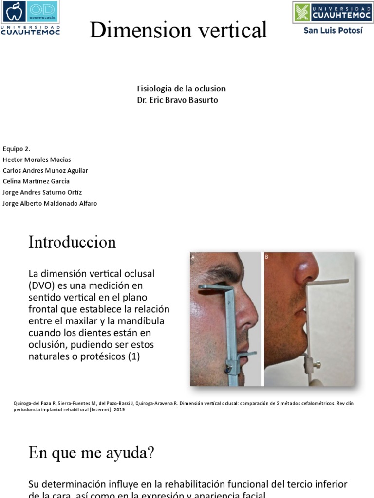 Dimensión Vertical Oclusal en Odontología | PDF | Odontología ...