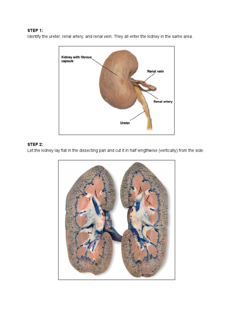 Kidney Dissection Guide PDF | PDF