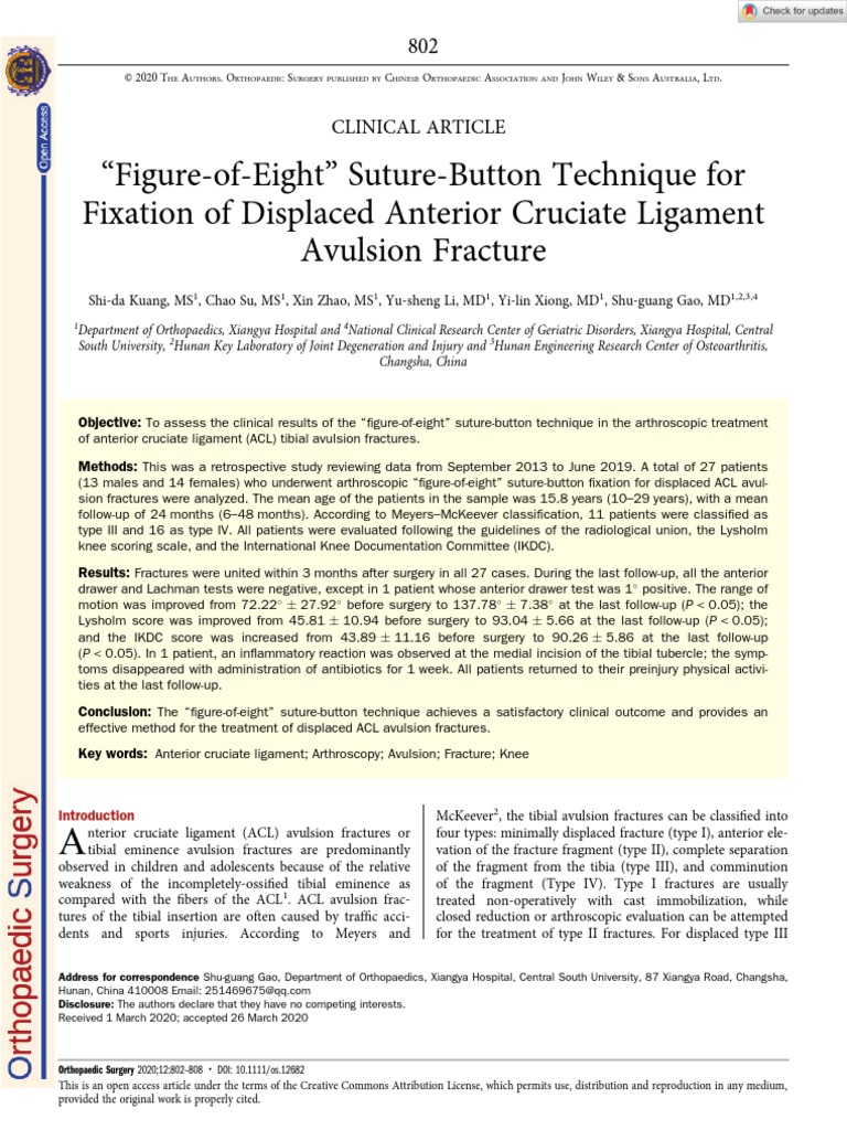 Orthopaedic Surgery - 2020 - Kuang - Figure of Eight Suture Button ...