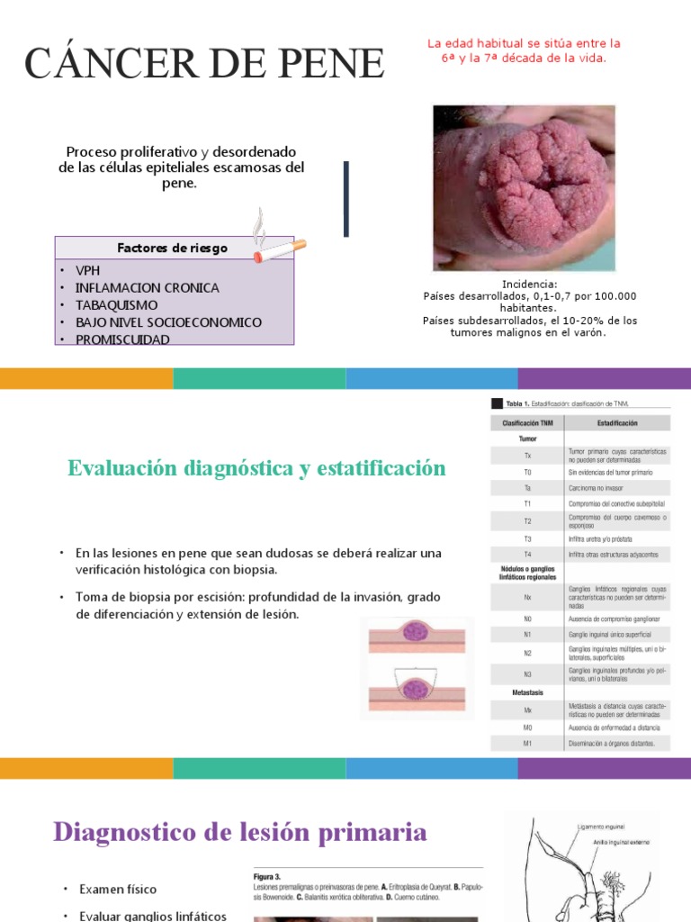 Cancer de Pene | PDF | Metástasis | Cáncer