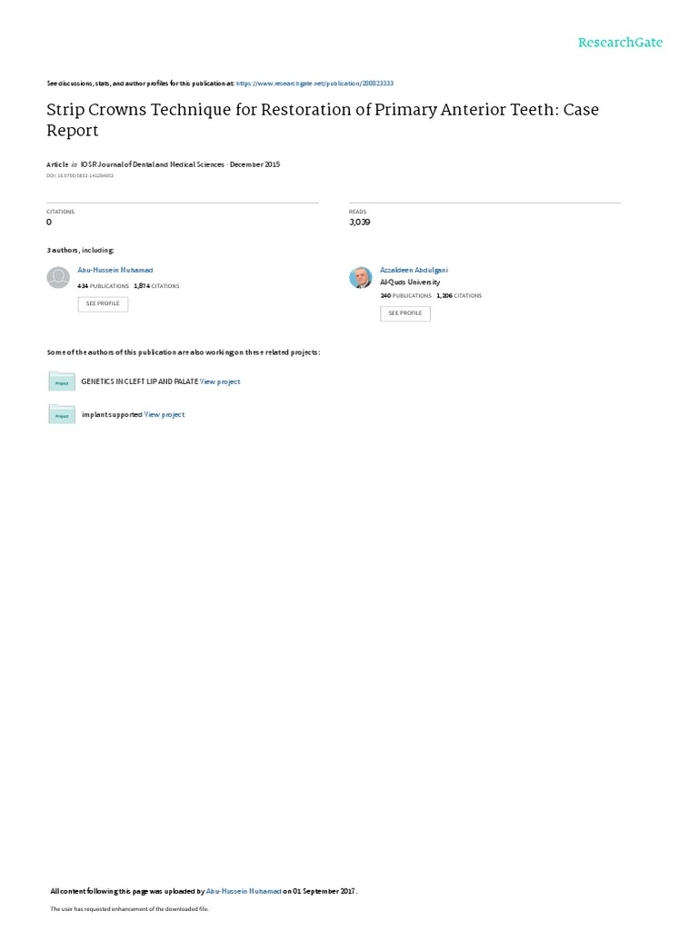 Strip Crowns Technique For Restoration of Primary Anterior Teeth: Case ...