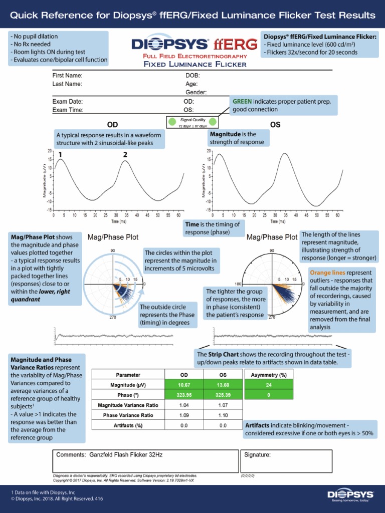 Quick Reference For Diopsys ffERG - Fixed Luminance Flicker Test ...