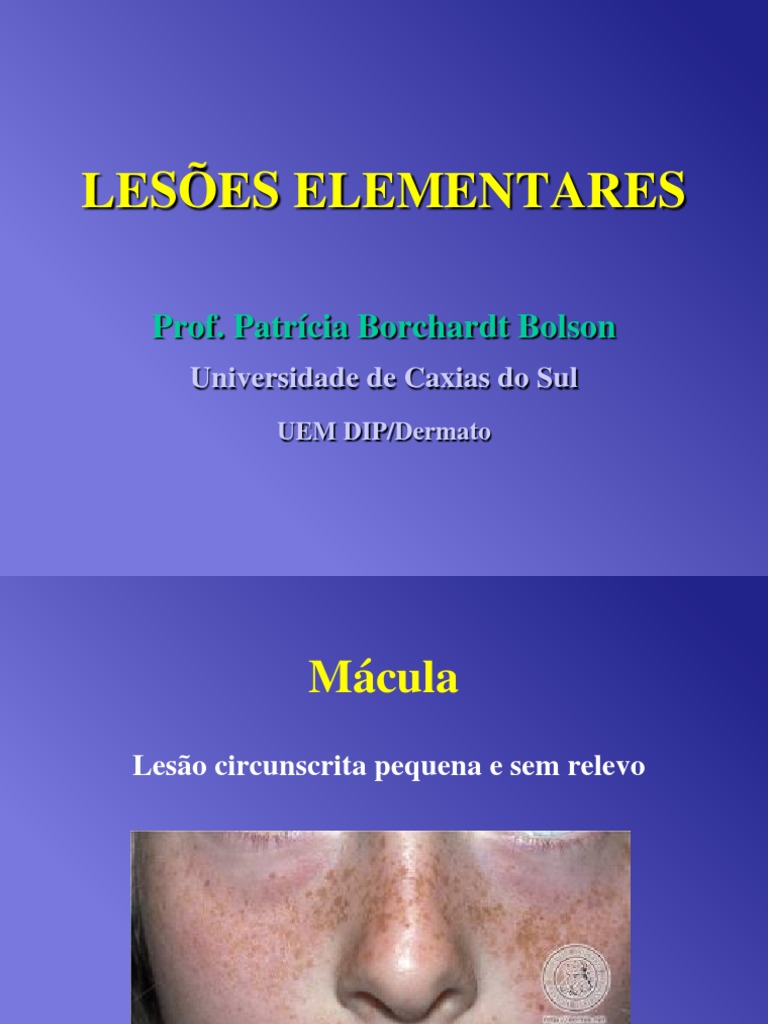 Lesões Elementares de Pele | PDF | Pele | Especialidades médicas