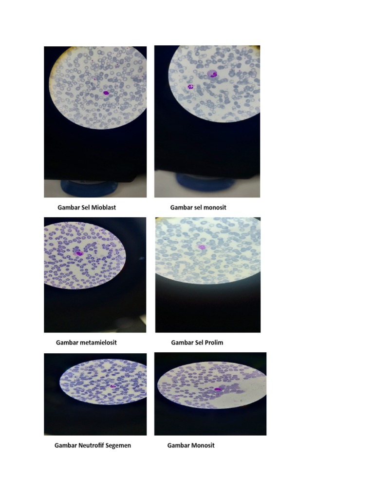 Gambar Sel Mioblast Gambar Sel Monosit | PDF