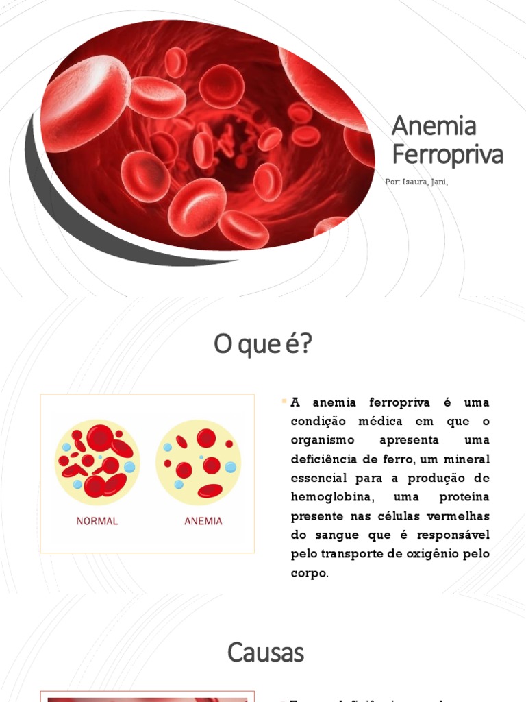 Anemia Ferropriva e Aplastica | PDF | Anemia | Ferro