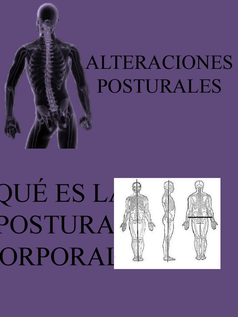 Alteraciones Posturales y Tratamientos | PDF | Trastornos ...