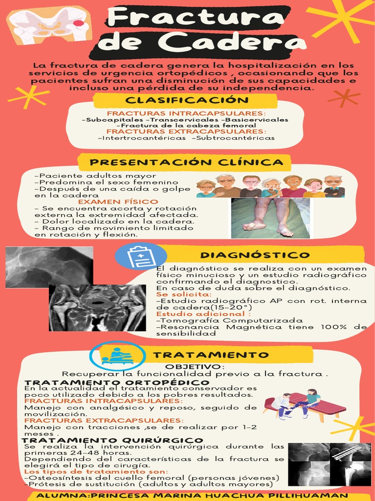 Infografia Fractura de Cadera 19 | PDF