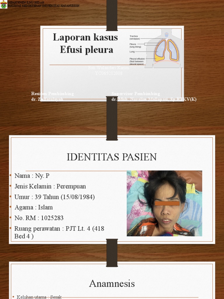 Efusi Pleura BTKV Esti | PDF