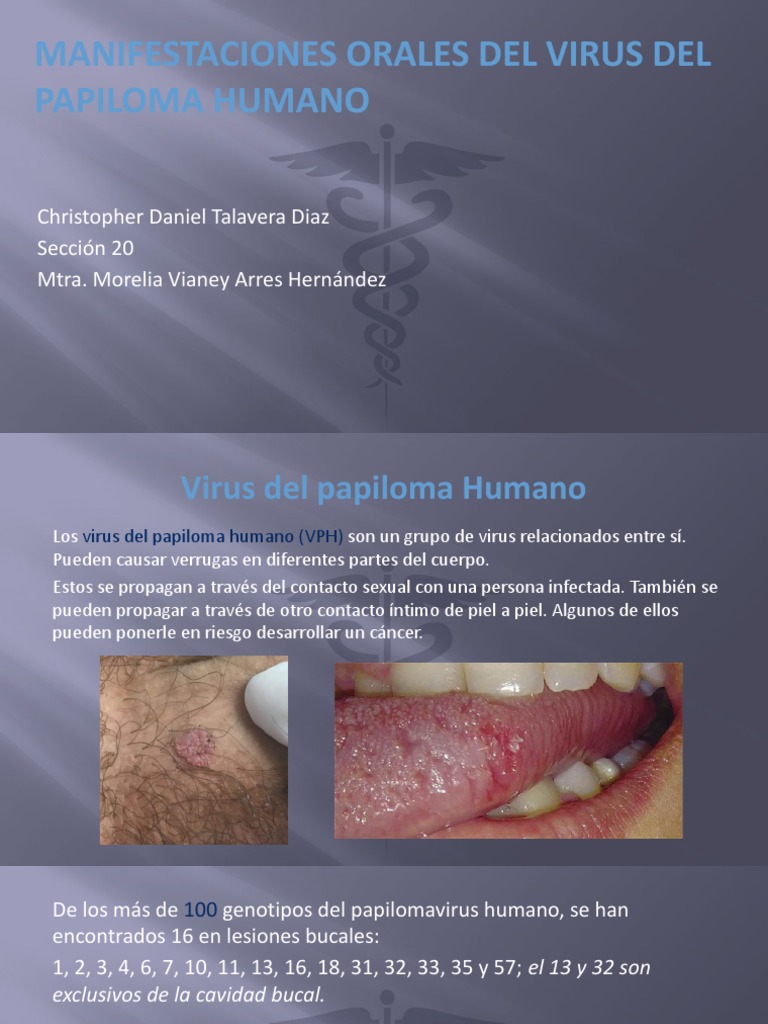 Manifestaciones Orales Del Virus Del Papiloma Humano | PDF | P53 | Cáncer