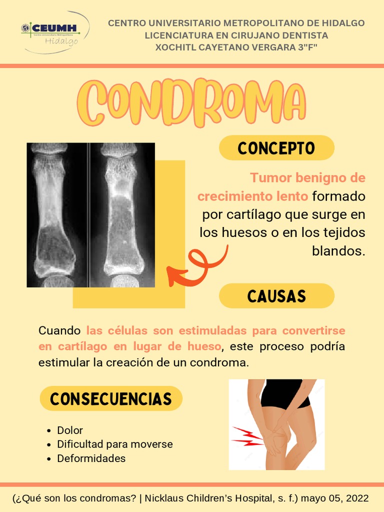 CONDROMA-PATOLOGÍA GENERAL | PDF