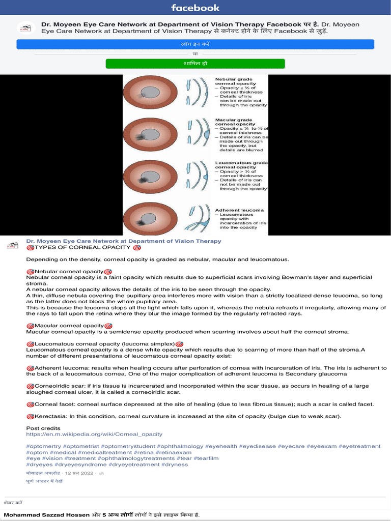 Dr. Moyeen Eye Care Network at Department of Vision Therapy - ?TYPES OF ...